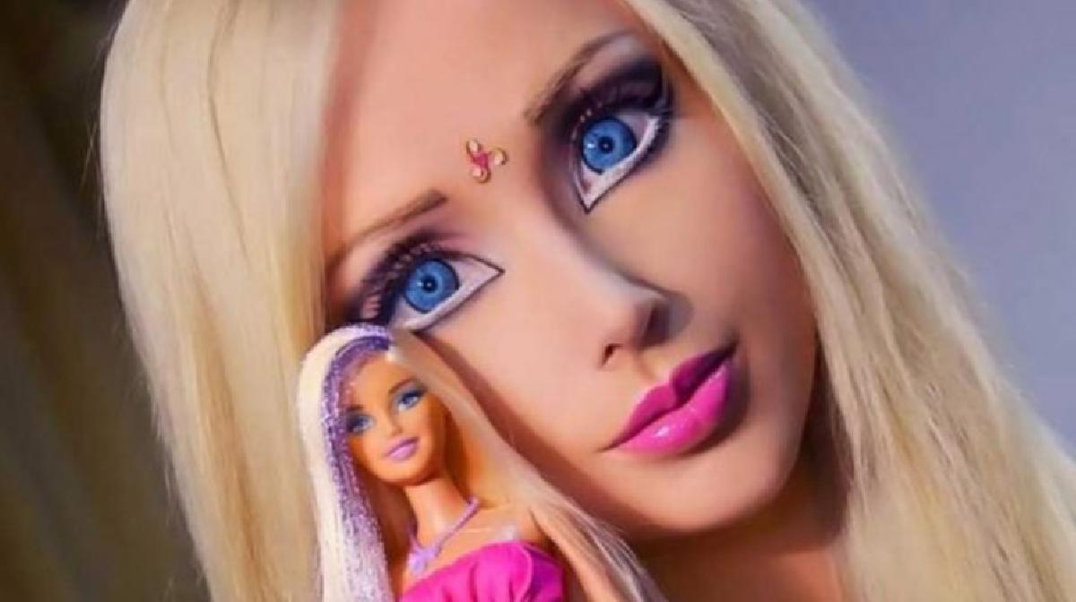 Cara De Barbie Humana Fotos: Barbie Humana Muestra Su Drástico Cambio